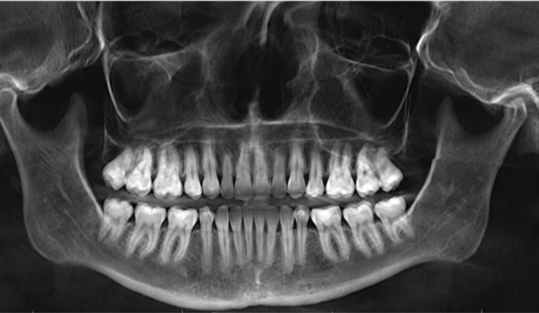 How CBCT Imaging Is Different From a Standard Dental X-Ray - Palermo ...